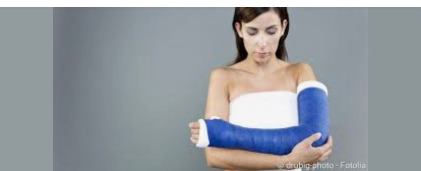 italki - Sie hat sich den Arm gebrochen, deswegen wurde ihr der Gips ...